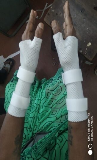 Low-temperature Thermoplastic splint – Rising Steps